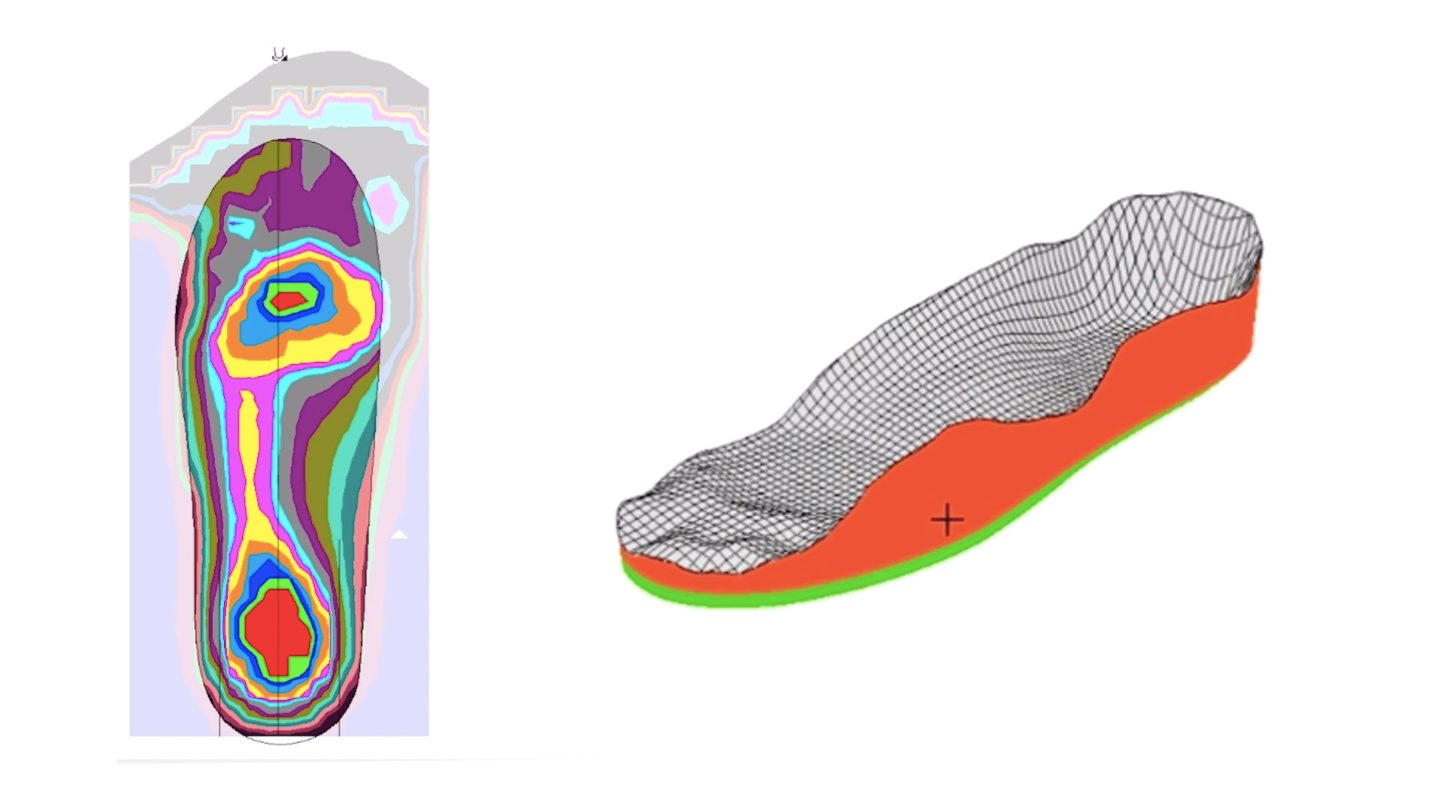 Kişiye Özel Tabanlık Ortopedik Yapım